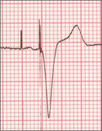 10 April – Heart rhythms